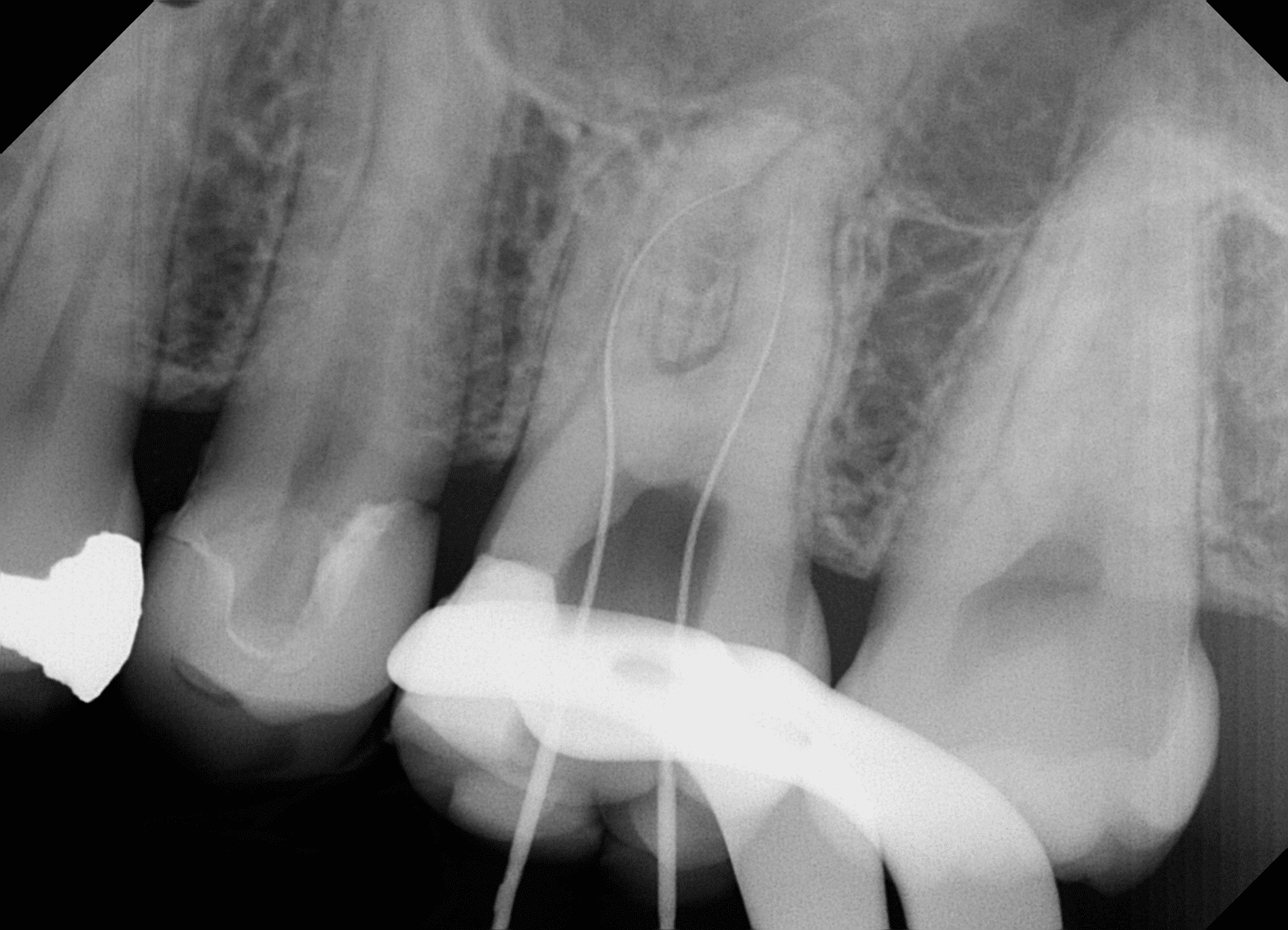 Top Tier Spatial Resolution for Visualization of Fine Detail - XDR ...