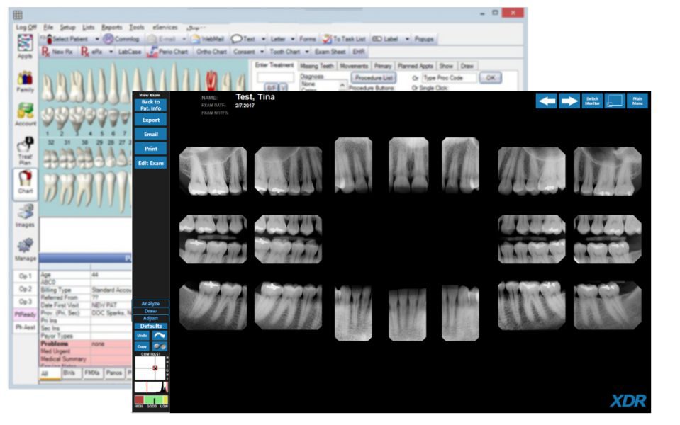 Landing Page OPENDENTAL - XDR Radiology