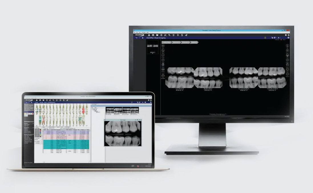 XDR Radiology Conversion Products | Upgrade Your Systems