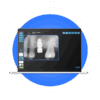 Dental Imaging Software | XDR Radiology