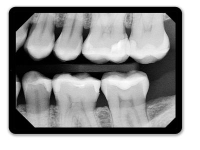 Shop Digital Dental X-Ray Sensors | XDR Radiology